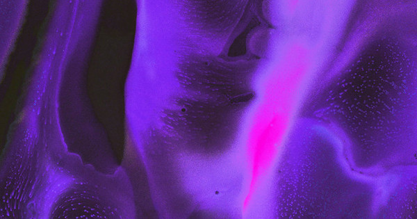 Avis Vox - 1000 Bites