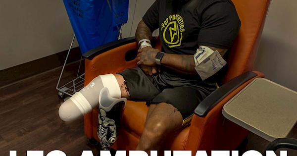 Flex Wheeler's Leg Amputation Explained ft. Flex Wheeler
