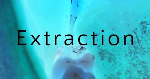Extraction