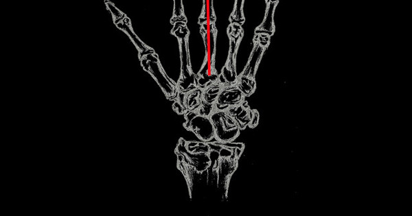 MISSIO - Middle Fingers