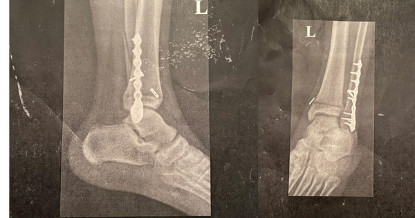 Mightymc - When I Bleed