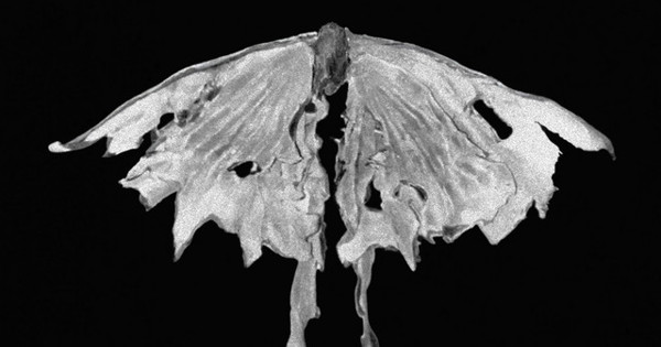 Dahee Park - Mangled